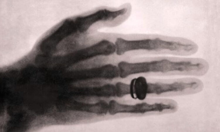 Cómo se descubrieron los Rayos X y su inventor